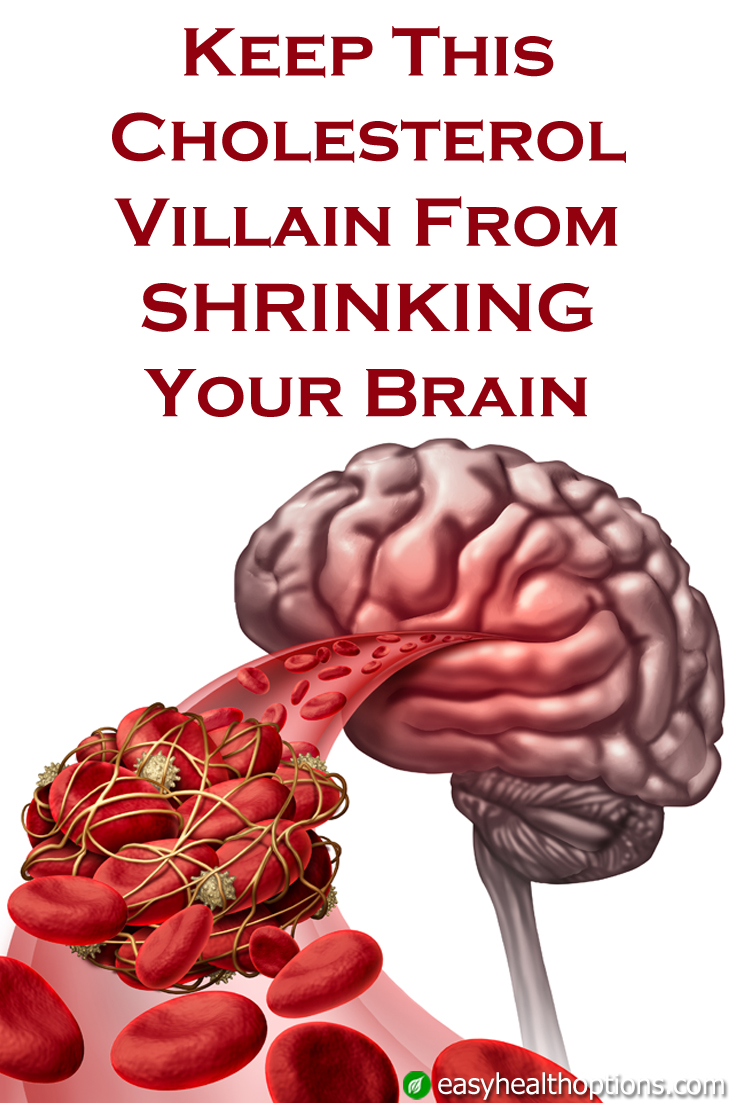Keep this cholesterol villain from shrinking your brain - Easy Health ...