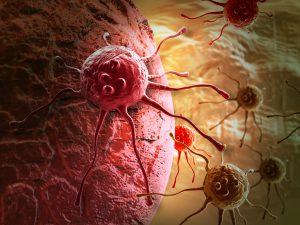 How to keep fat cells from growing breast cancer - Easy Health Options®