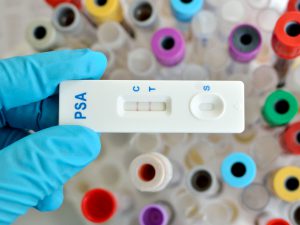 What causes PSA levels to rise? - Easy Health Options®