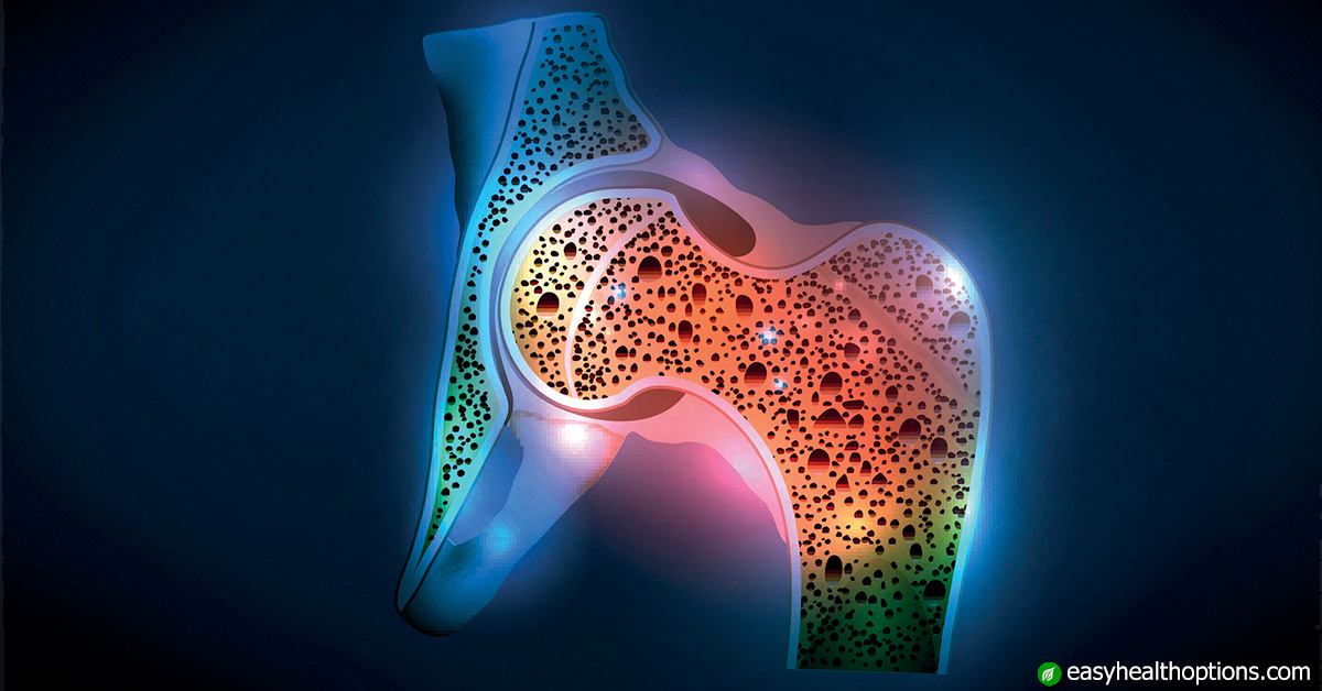 5 Surprising Things Making Your Bones Brittle slideshow Easy Health 5 Surprising Things Making Your Bones Brittle slideshow Easy Health