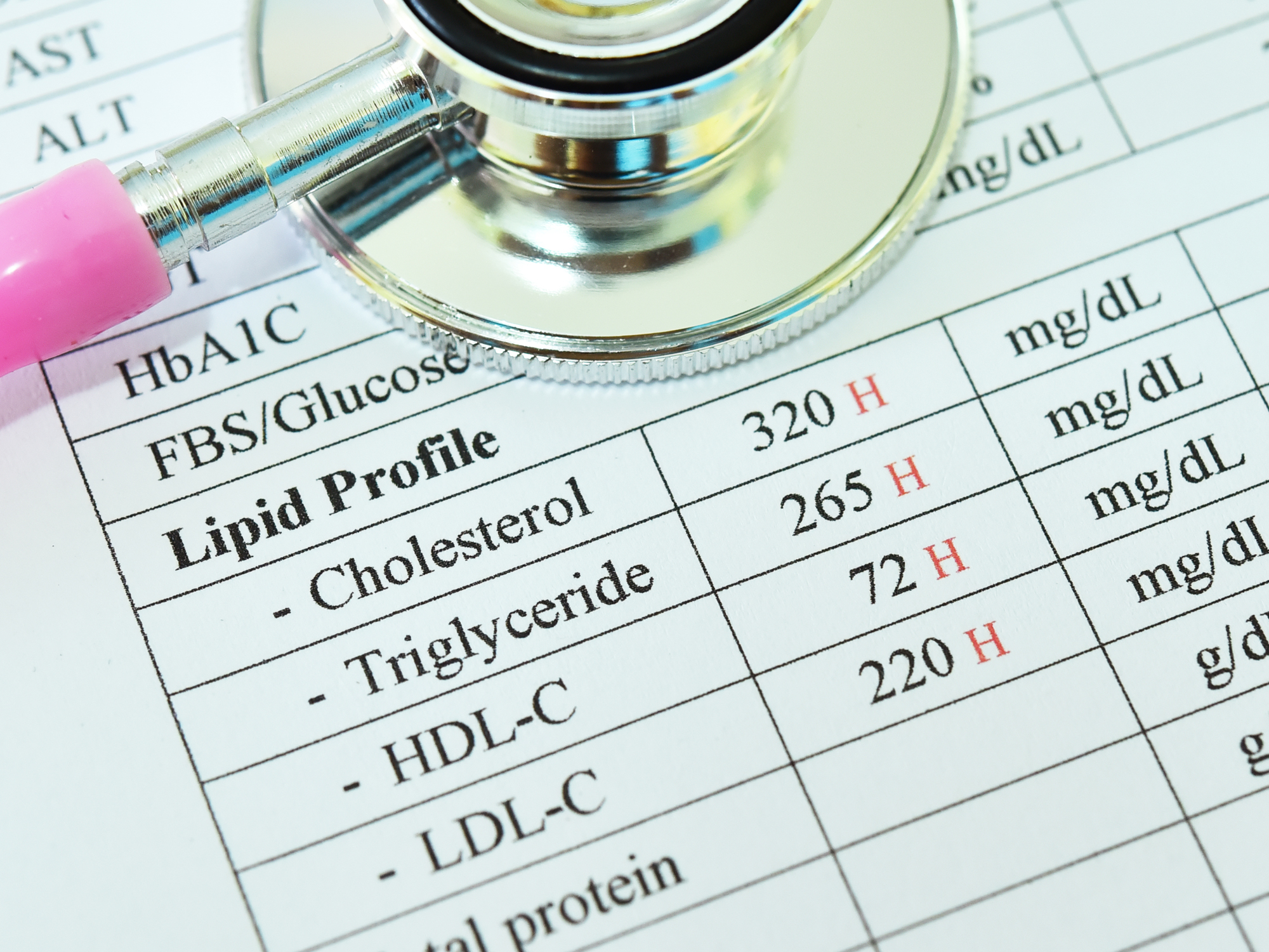 What They Left Out Of The New Cholesterol Guidelines Easy Health Options What They Left Out Of The New Cholesterol Guidelines Easy Health Options